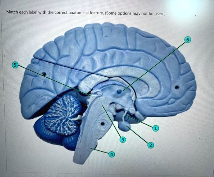 SOLVED: options include:- inferior colliculus- thalamus- fourth ...