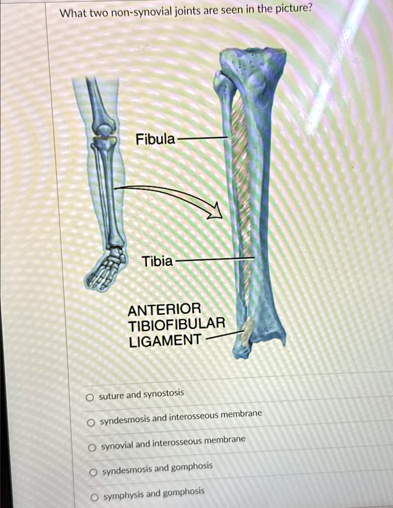 What two non-synovial joints are seen in the picture? Fibula Tibia ...