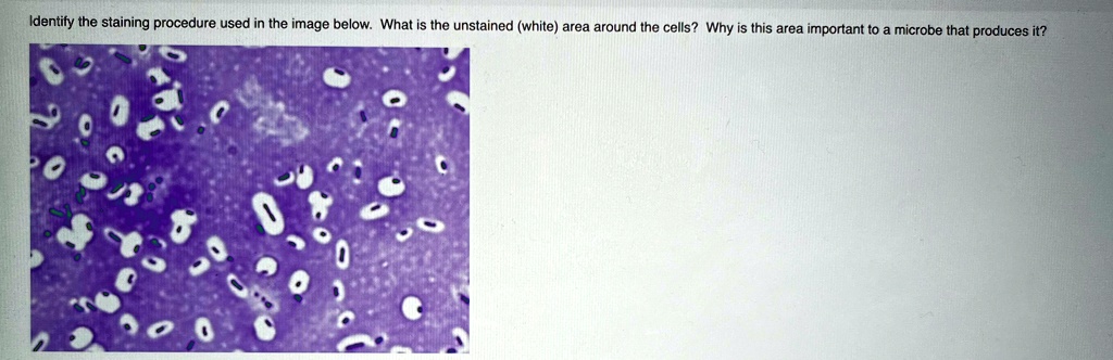 identify the staining procedure used in the image below what is the ...