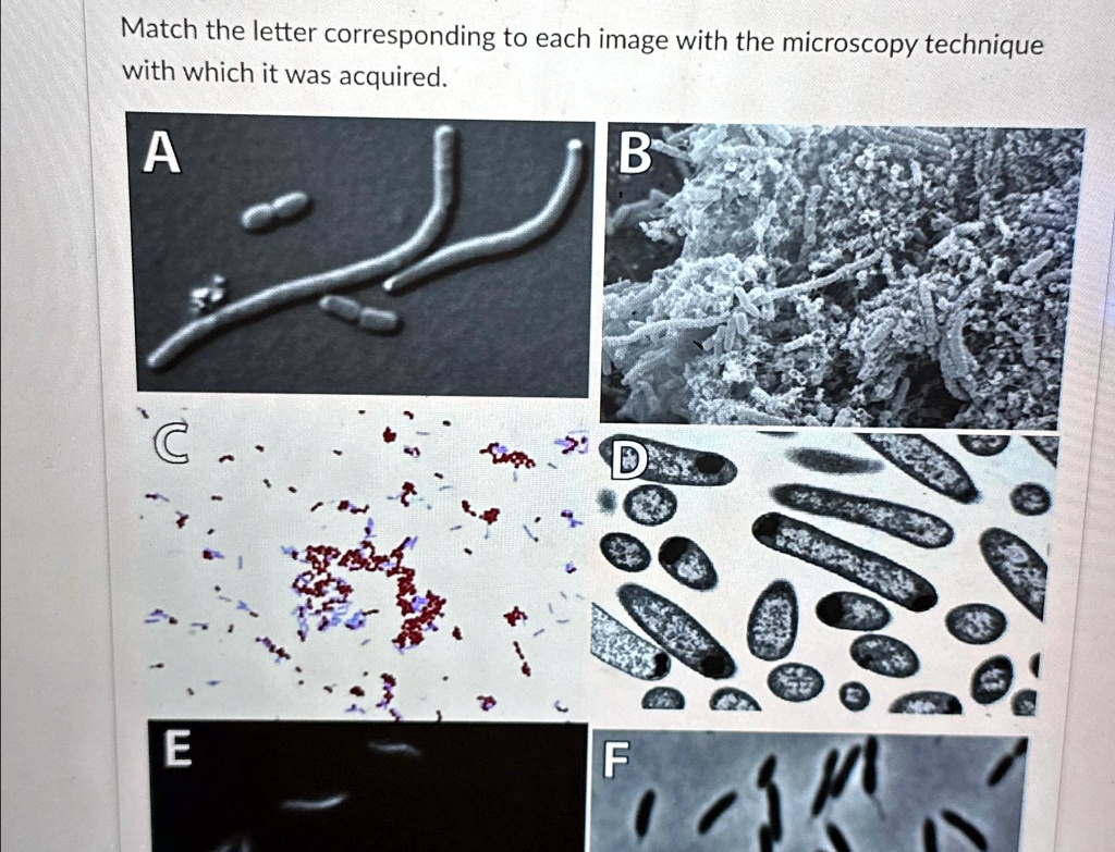 Match the letter corresponding to each image with the microscopy ...