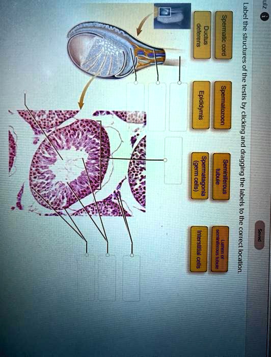Label the structures of the testis by clicking and dragging the labels ...