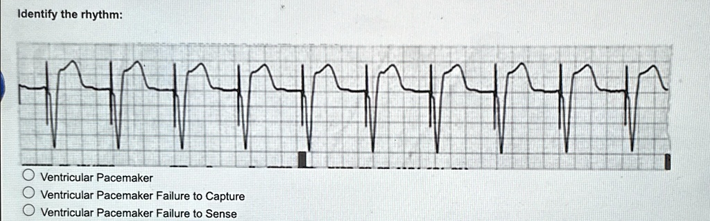 identify the rhythm ventricular pacemaker ventricular pacemaker failure ...