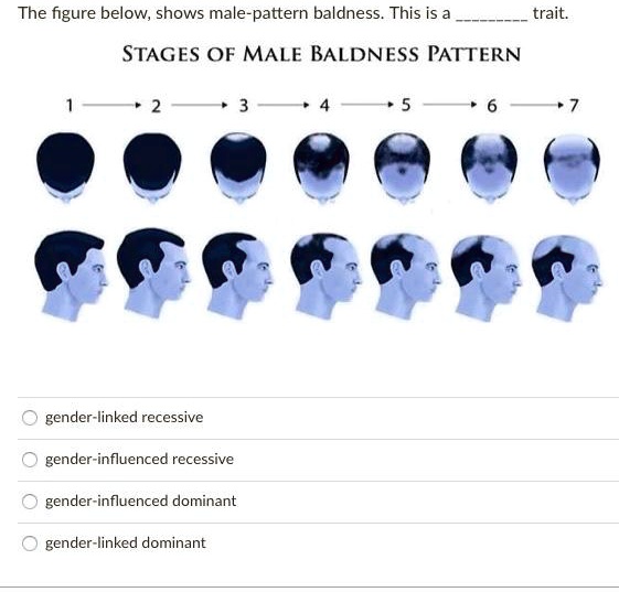 The figure below, shows male-pattern baldness. This is a trait. STAGES ...
