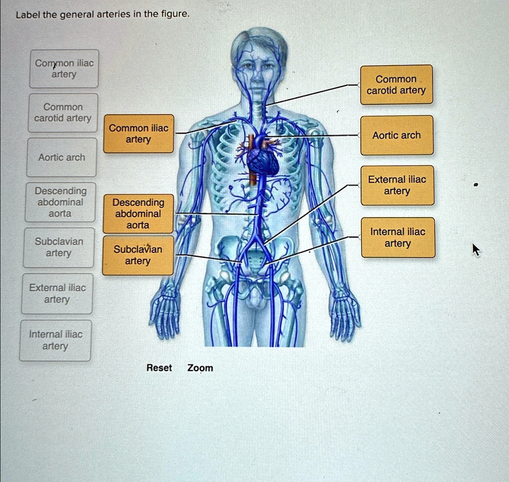 SOLVED: Label the general arteries in the figure. Label the general ... SOLVED: Label the general arteries in the figure. Label the general ...