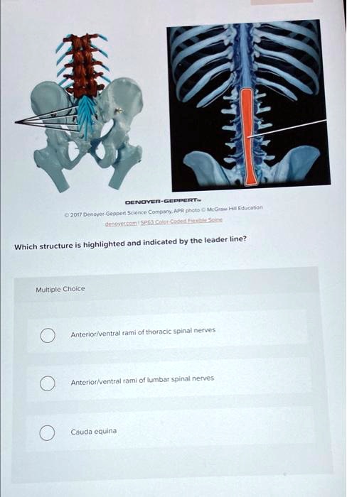 DENOVER-GEPPERT- ©2017 Denoyer-Geppert Science Company, APR photo ...