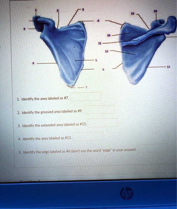 SOLVED: Identify the area labeled as #7 Identify the grooved area ...