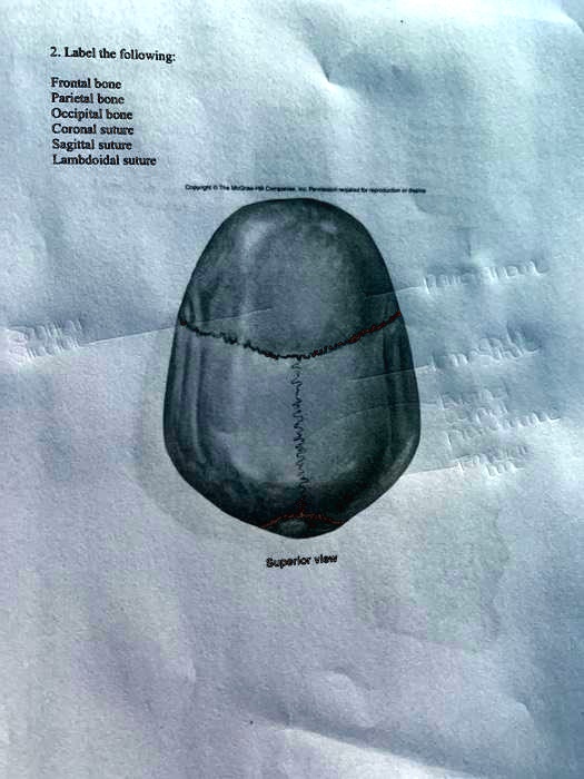 SOLVED: Label the following: - Frontal bone - Parietal bone - Occipital ...