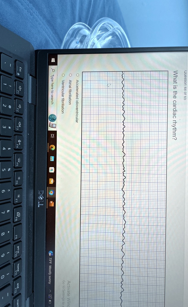 question 48 of 65 what is the cardiac rhythm o accelerated ...