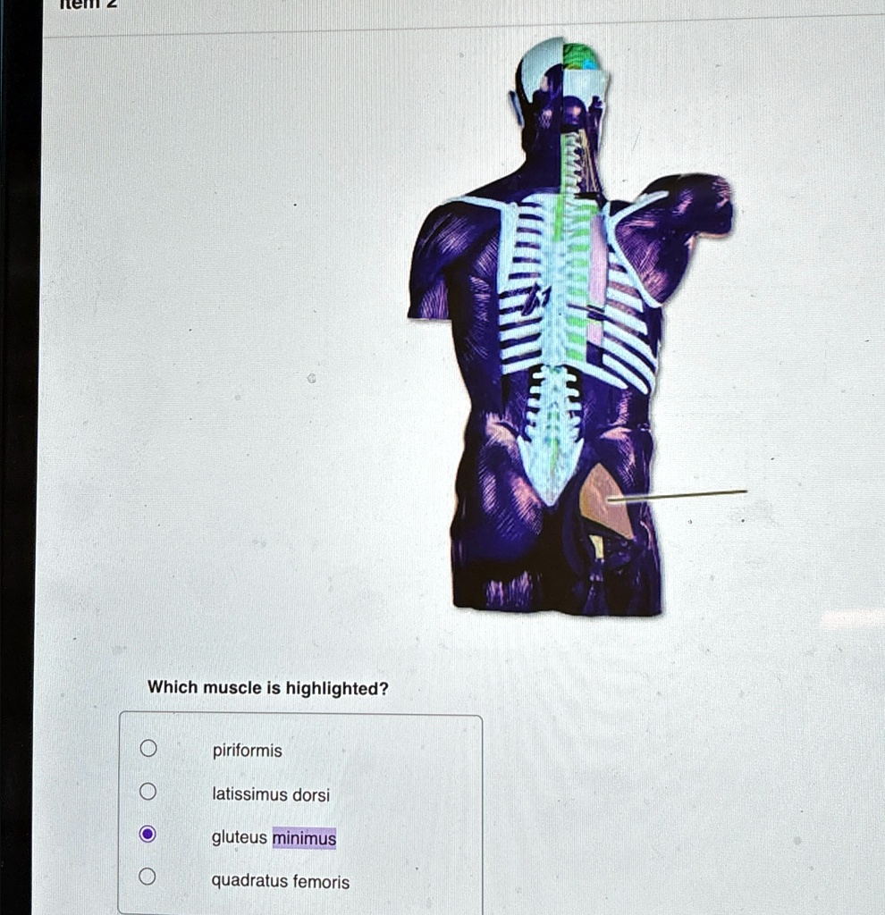 Which muscle is highlighted? able[[piriformis],[latissimus dorsi ...