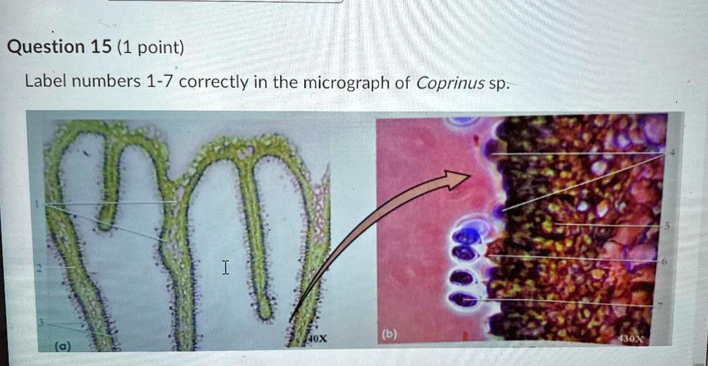 SOLVED: Question 15 (1 point) Label numbers 1-7 correctly in the ...