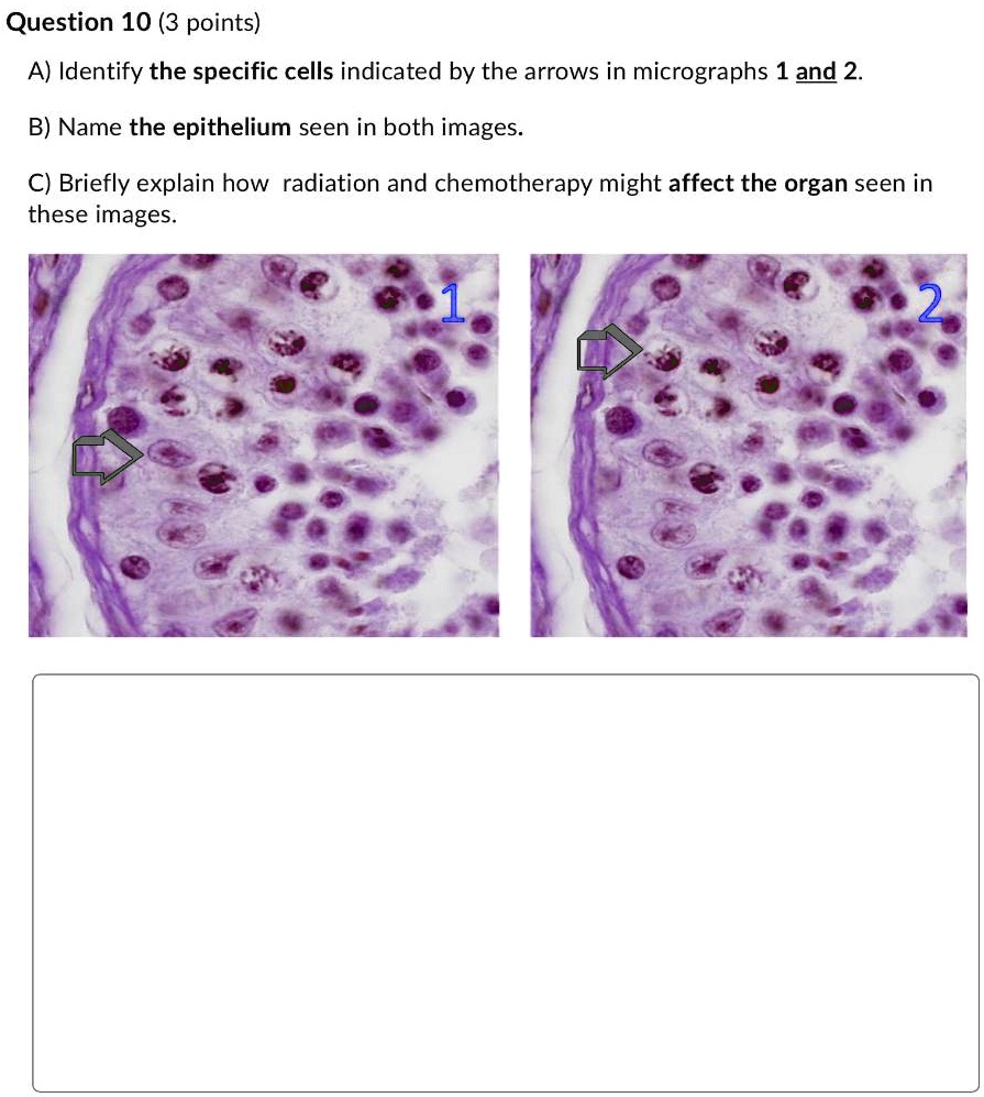 SOLVED: Question 10 (3 points) A) Identify the specific cells indicated ... SOLVED: Question 10 (3 points) A) Identify the specific cells indicated ...