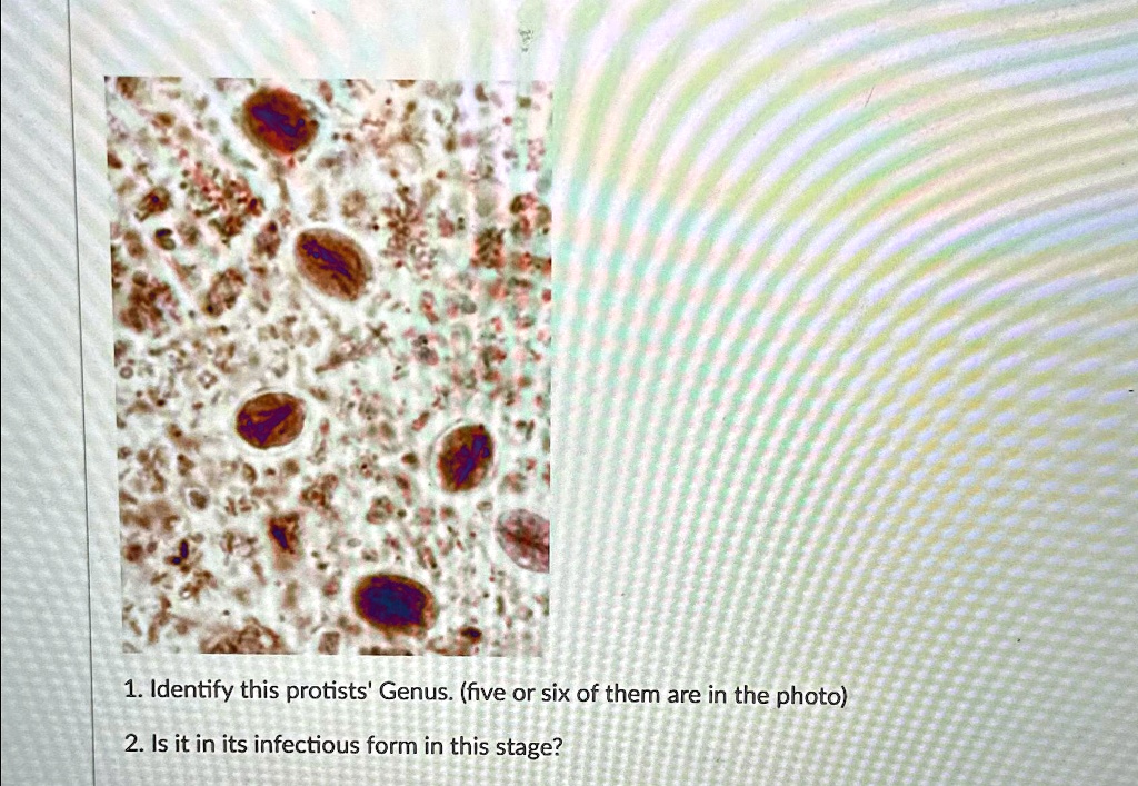 SOLVED: Identify this protists' Genus. (five or six of them are in the ...