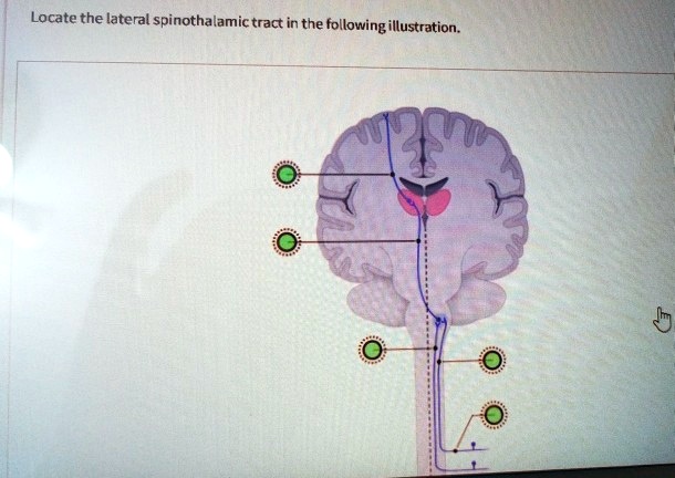 SOLVED: Locate the lateral spinothalamic tract in the following ...