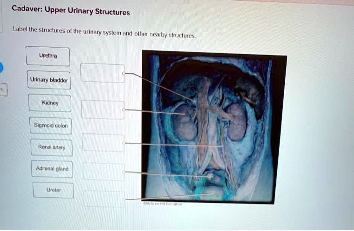 SOLVED: Label the structures of the urinary system and other nearby ...