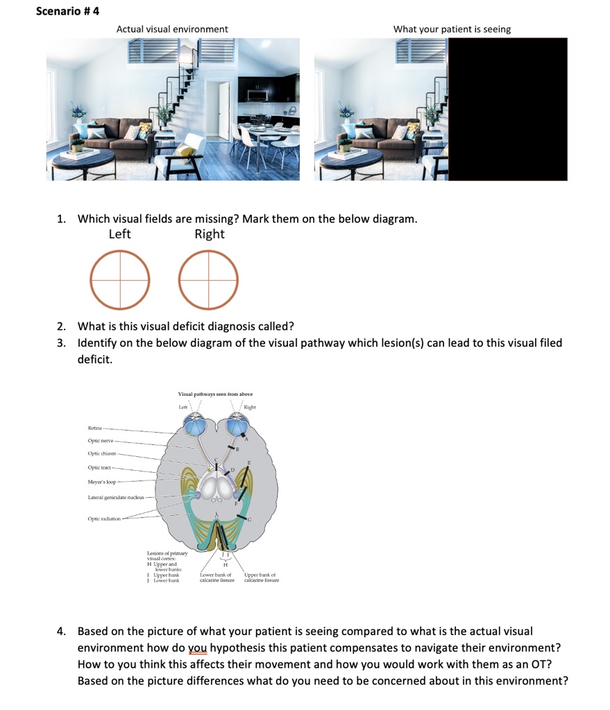 Scenario # 4 Actual visual environment What your patient is seeing 1 ...