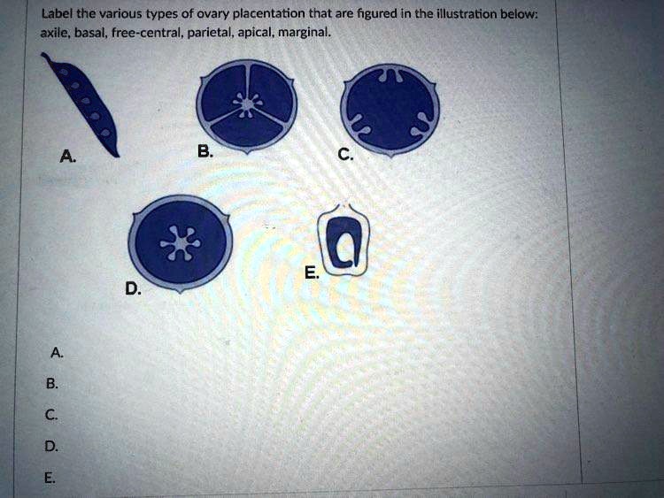 SOLVED: Plant Anatomy Label the various types of ovary placentation ...