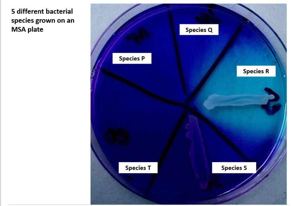 SOLVED: #1 Shown below are 5 different bacterial species grown on an ...