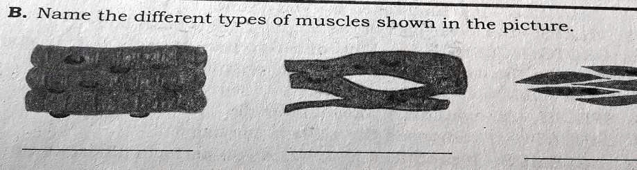 B. Name the different types of muscles shown in the picture.