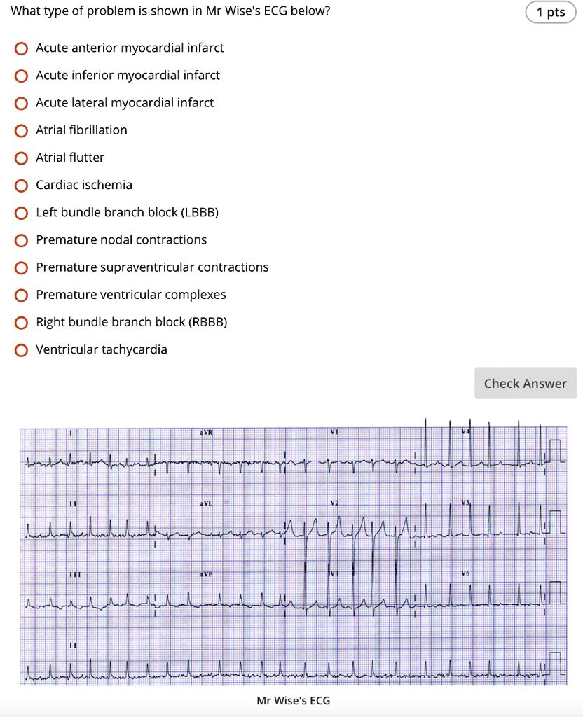 what type of problem is shown in mr wises ecg below acute anterior ...