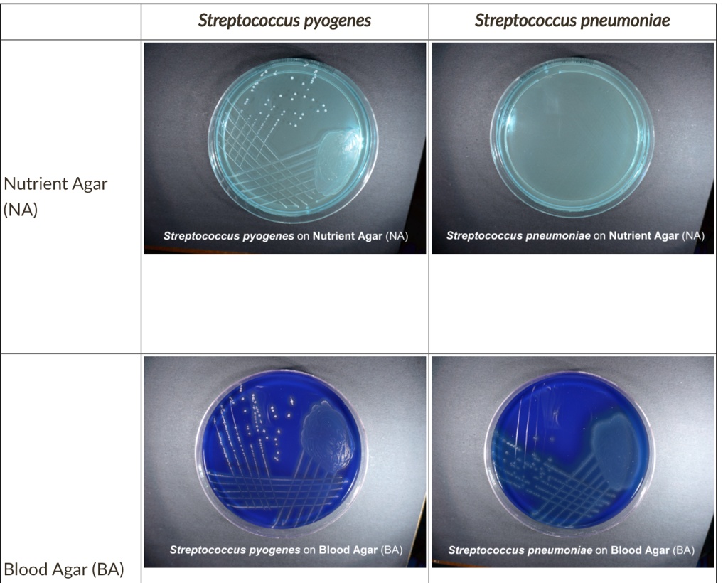 SOLVED: Streptococcus pyogenes Streptococcus pneumoniae Nutrient Agar ...