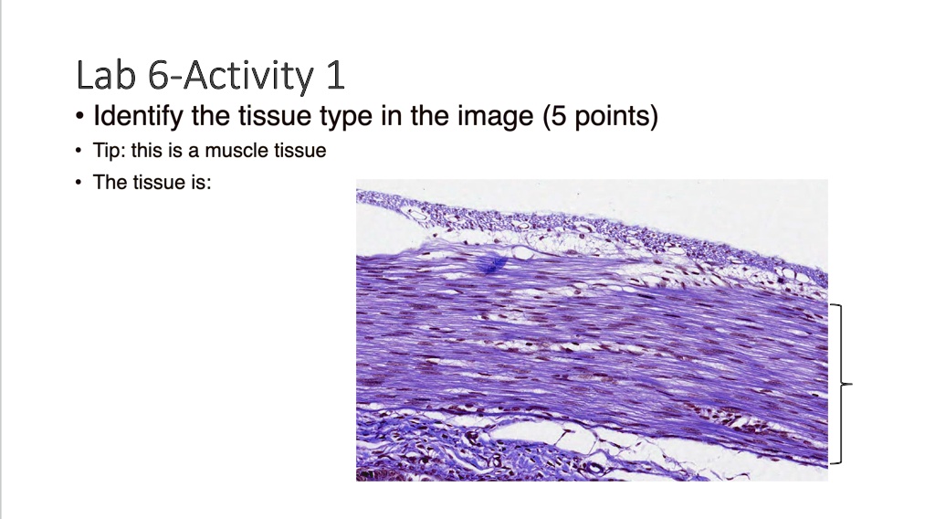 SOLVED: 'Identify the tissue type in the image. Hint: It is a muscle ...