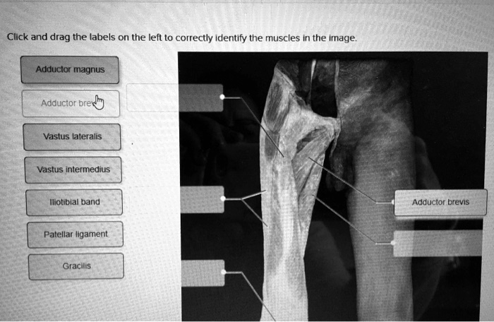 SOLVED: Click and drag the labels on the left to correctly identify the ...