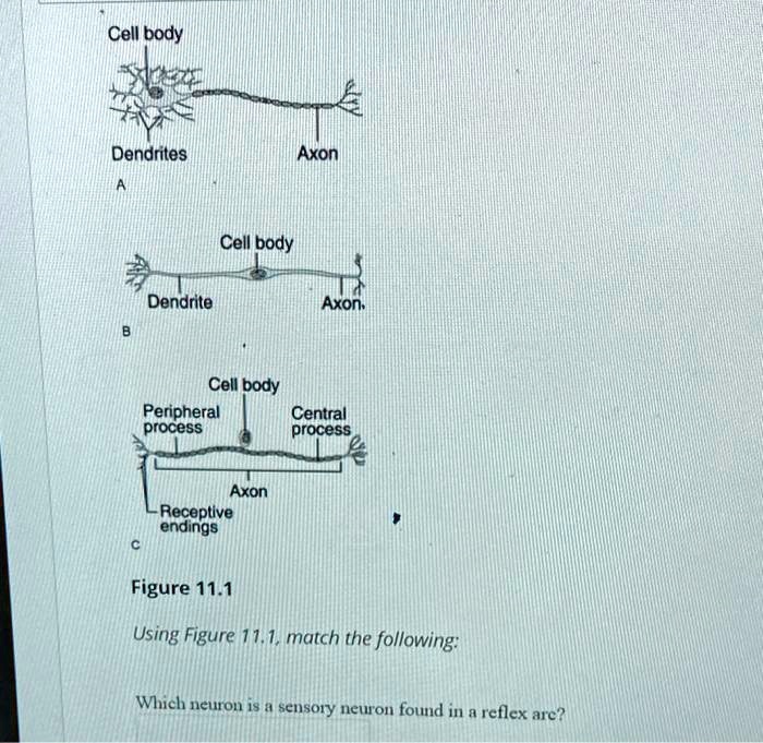 Cell body Dendrites Axon A Cell body Dendrite Axon. B Cell body ...