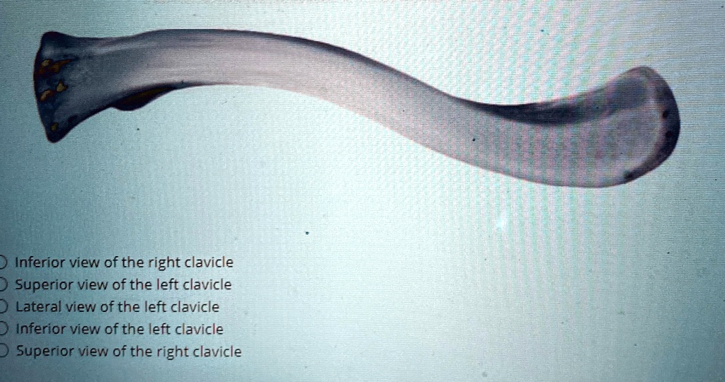 [GET ANSWER] ? Inferior view of the right clavicle ? Superior view of ...