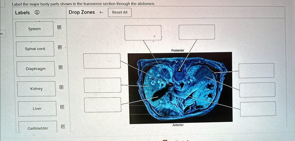 Label the major body parts shown in the transverse section through the ...