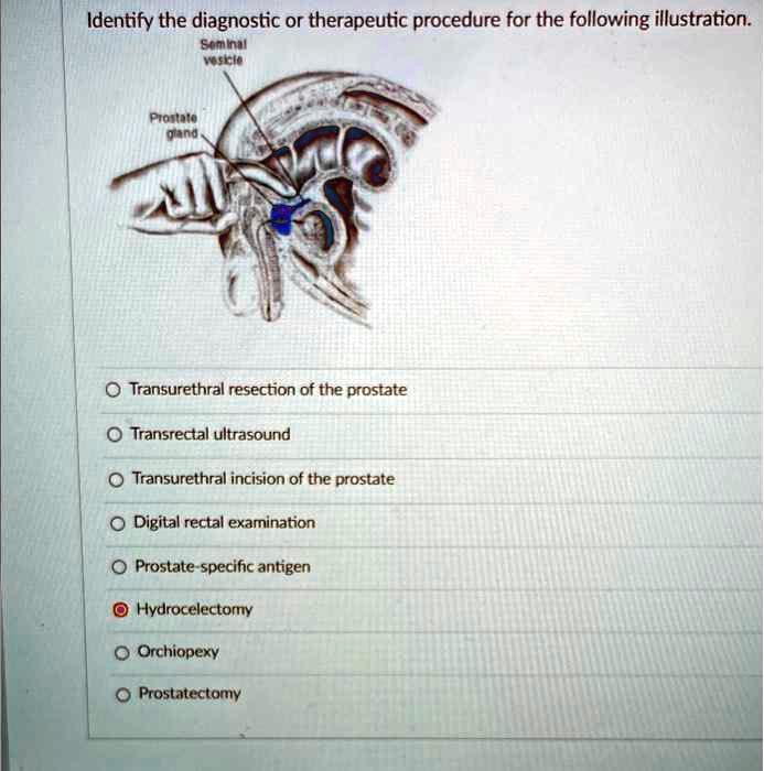 SOLVED: Identify the diagnostic or therapeutic procedure for the ...