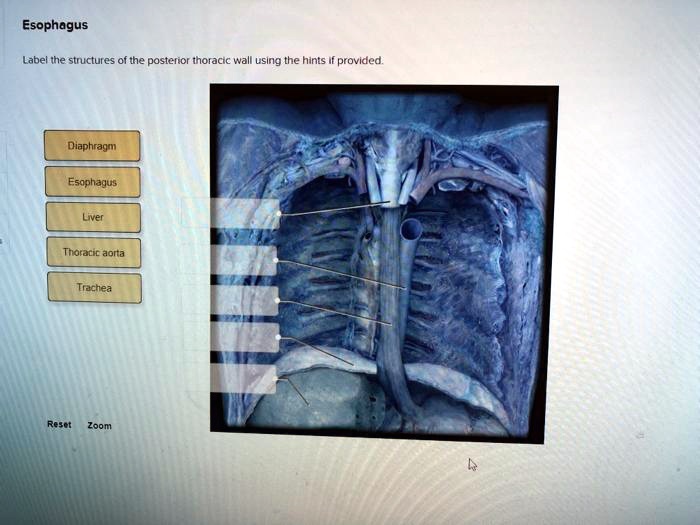 VIDEO solution: Label the structures of the posterior thoracic wall ...