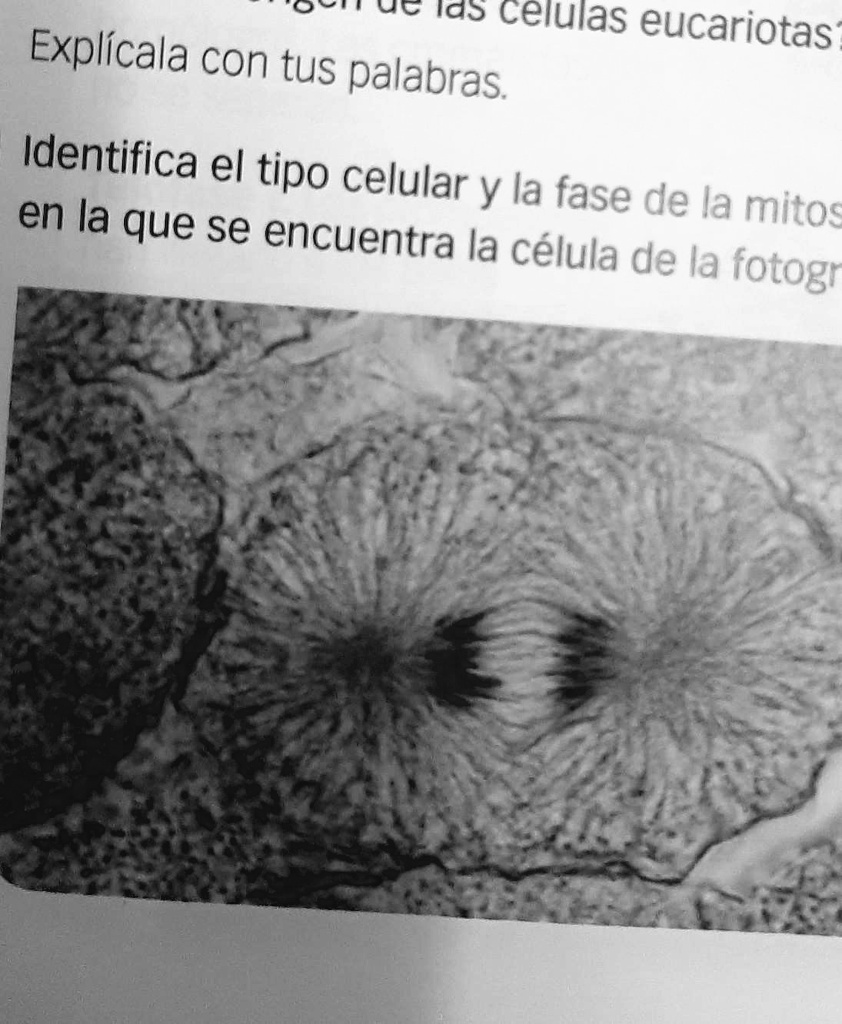 SOLVED: Identifica el tipo celular y la fase de la mitosis en la que se ...