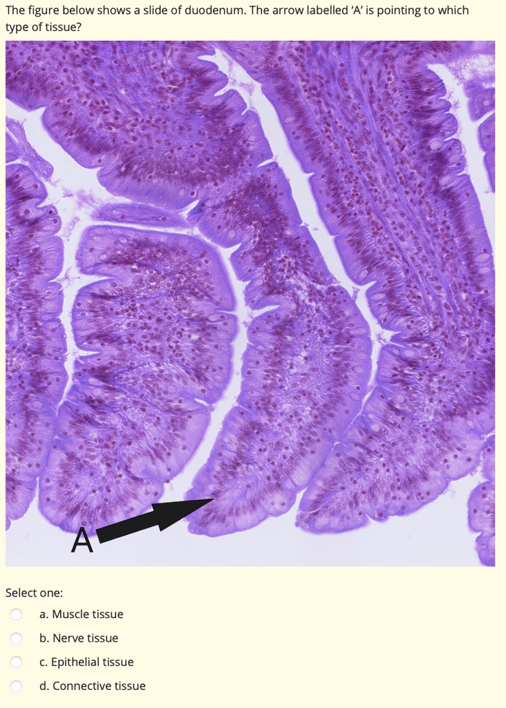 SOLVED: The figure below shows a slide of duodenum: The arrow labelled ...