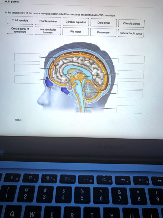 SOLVED: 0.21 points label the structures assoclated with CSF ...