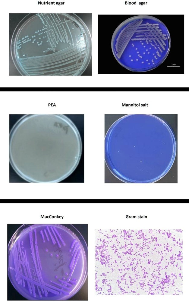 nutrient agar blood agar pea mannitol salt macconkey gram stain 33994