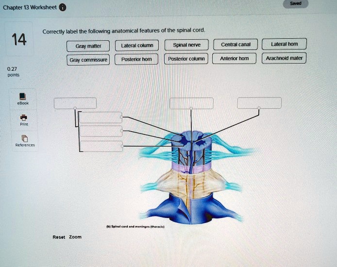 SOLVED: correctly label the following anatomical features of the spinal ... SOLVED: correctly label the following anatomical features of the spinal ...