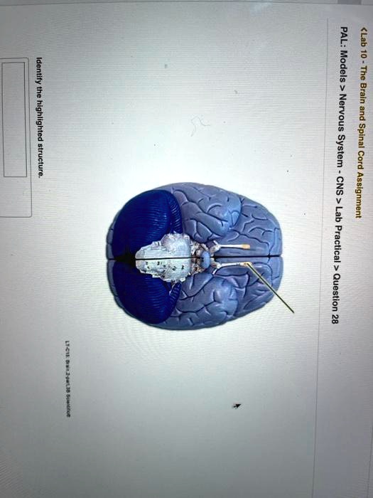 Nervous System - CNS > Lab Practical > Question 28 Identify the highlighted structure. LT-C15 ...