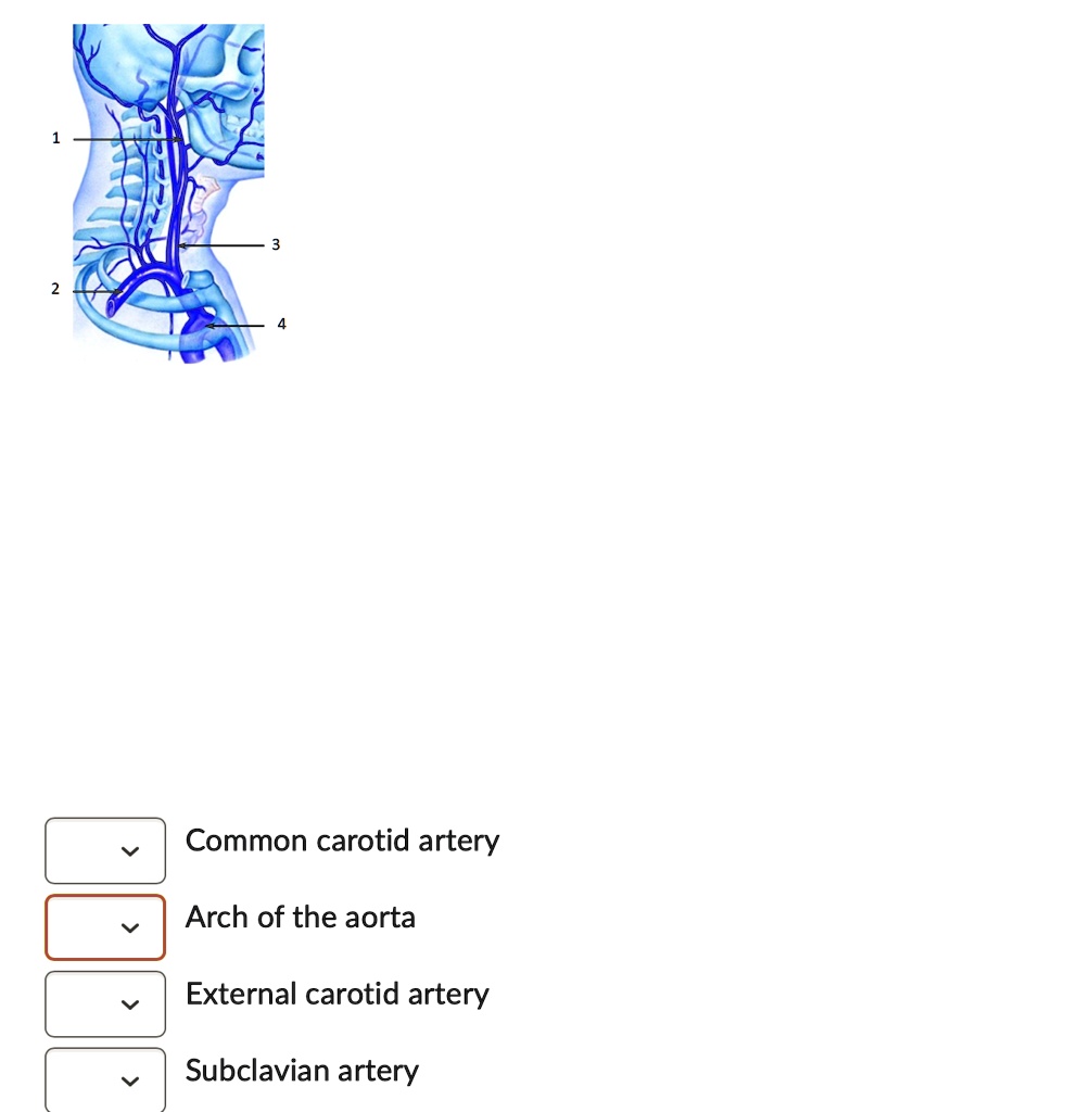 1 3 2 4 Common carotid artery Arch of the aorta External...