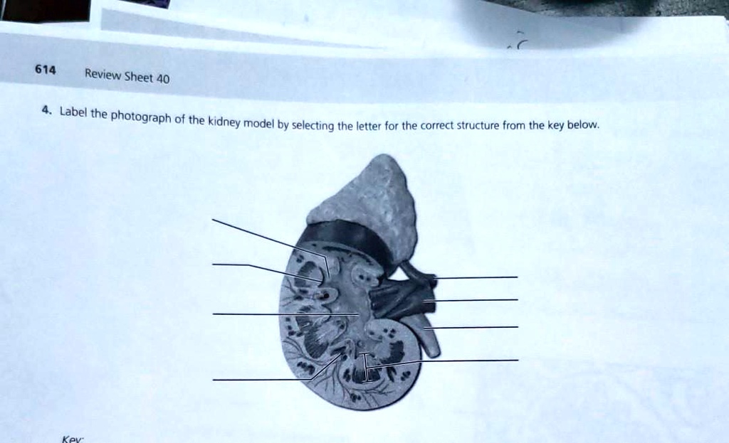 SOLVED: 614 Review 'Sheet 40 Label the photograph of the kidney model by 'selecting the letter ...