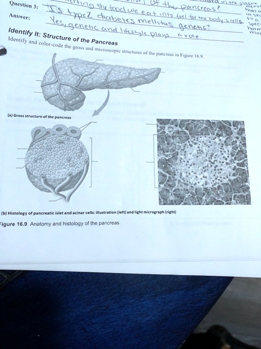 SOLVED: Question 3: What is the structure of the pancreas and how does ...