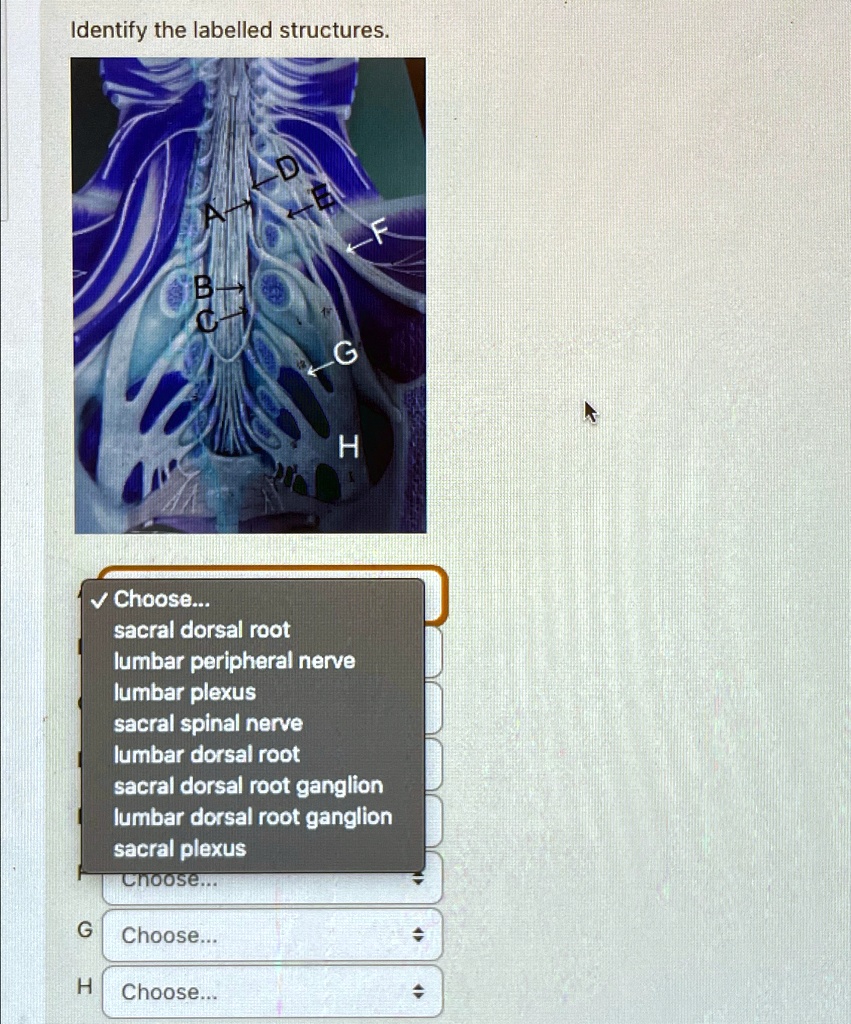 identify the labelled structures i need to pick one of the options for ...