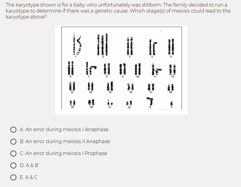 the karyotype shown is for a baby who unfortunately was stillborn the ...