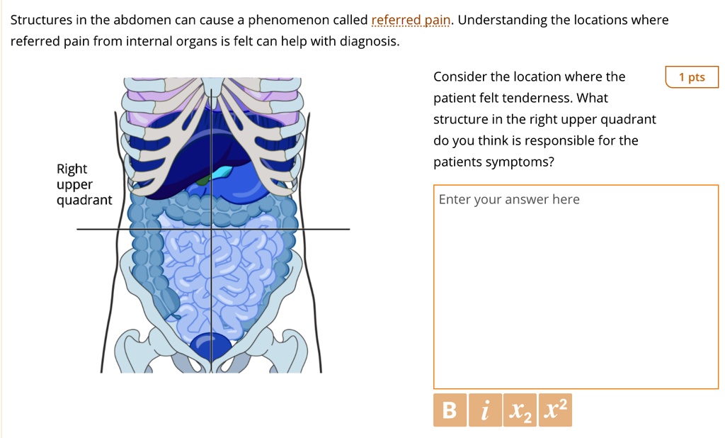Structures in the abdomen can cause a phenomenon called referred pain ...