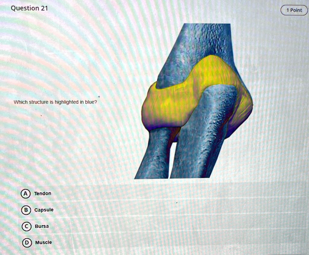 Question 21 Which structure is highlighted in blue? A Tendon B Capsule ...