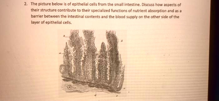2. The picture below is of epithelial cells from the small intestine ...