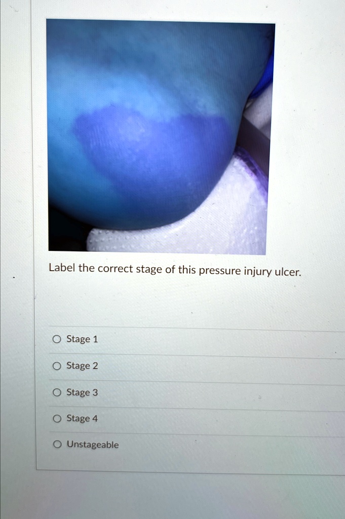 Label the correct stage of this pressure injury ulcer: - Stage 1 ...