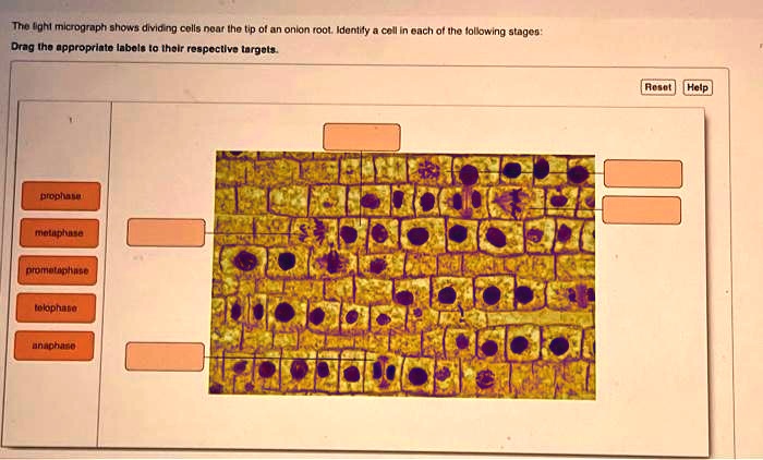 SOLVED: The light micrograph shows dividing cells near the tip of an ...