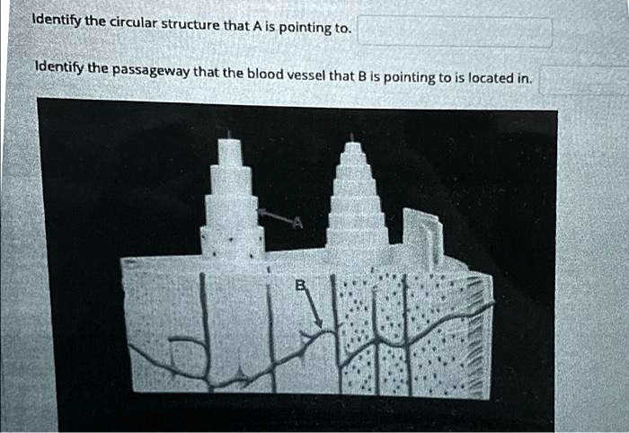 SOLVED: Identify the circular structure that A is pointing to. Identify the passageway that the ...