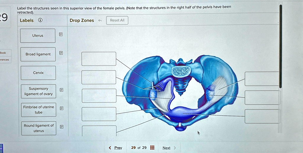 SOLVED: Label the structures seen in this superior view of the female ... SOLVED: Label the structures seen in this superior view of the female ...