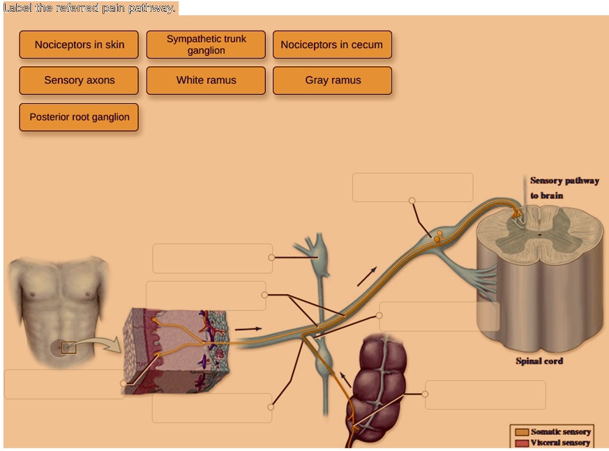 Label the referred pain pathway. Nociceptors in skin Sympathetic trunk ...